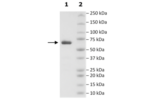 PARP14, His-GST-Tag Recombinant PARP14 80514