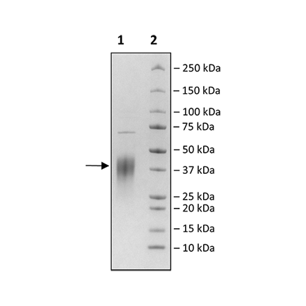 Activin RIIB (ACVR2B), His-Avi-Tag, Biotin-Labeled Recombinant ACVR2B ...